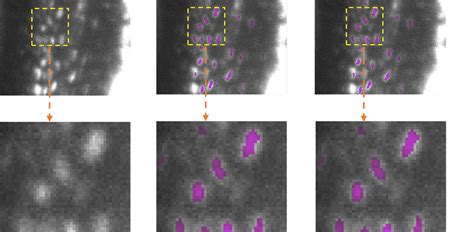 Analysis Of Microscopic Images New Open Source Software Makes Ai