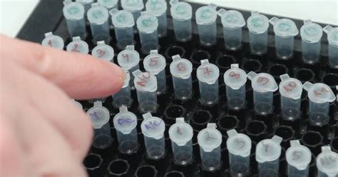 24 са новите случаи на коронавирус 169 души са приети в болница ОБНОВЕНА Bgonair