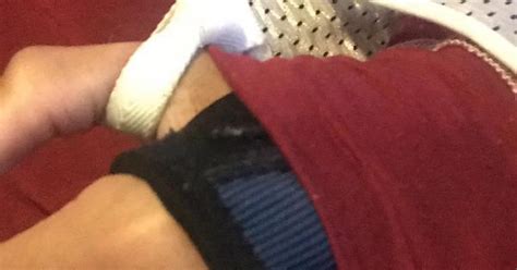 Hand On Ice And Splint Due To New Xbox Controller Design Album On Imgur