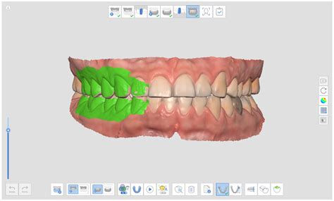 Occlusion Scan Medit Help Center