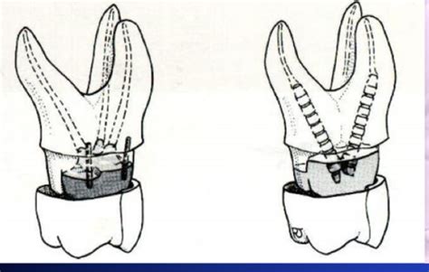 Spring Exam 2 Flashcards Quizlet Spring Exam 2 Flashcards Quizlet