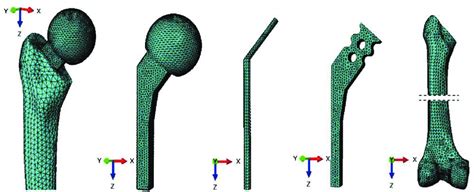 Finite Element Meshes Of Hip Prosthesis Components Hip Spacer Implant Download Scientific
