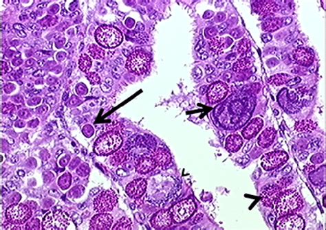 Microfotografía De íleon Donde Se Aprecia El Epitelio Con Un Alto Grado