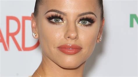 Adriana Chechik Reveals Extent Of Heartbreaking Injuries In Return Stream