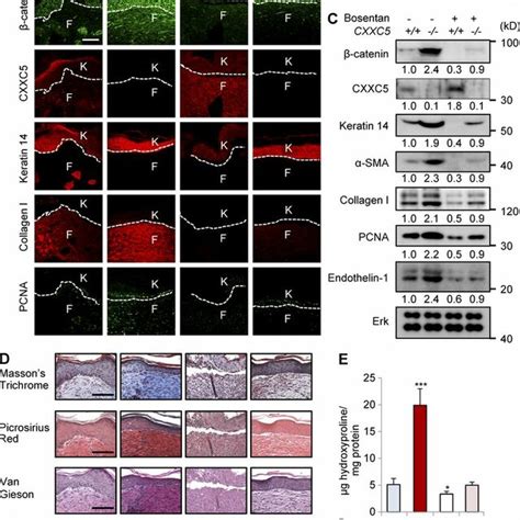 Cxxc5 Attenuates Myofibroblast Differentiation And Collagen Production Download Scientific