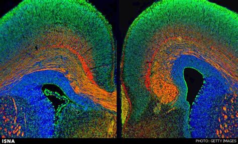 دنیای پیچیده و رنگی درون مغز در تصاویری خارق‌العاده تسنیم