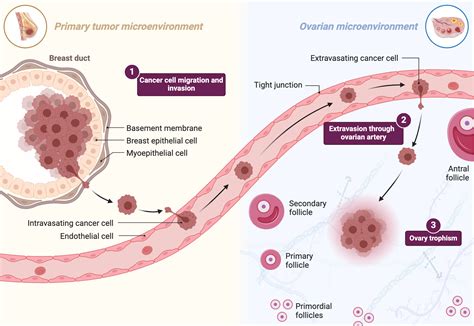 Tumor Metastasis Layout 2 Biorender Science Templates