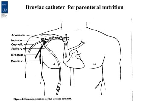 Ppt Venous Acess Care Powerpoint Presentation Free Download Id9332009