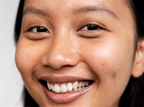 What Causes Bags Under Eyes And Puffiness