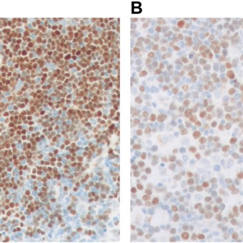 Immunohistological Staining For Detection Of The Expression Of Cyclin