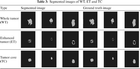 cmc free full text emu net automatic brain tumor segmentation and