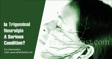 Trigeminal Neuralgia Microvascular Decompression Stereotactic Radiosurgery Trigeminal Neuralgia Microvascular Decompression Stereotactic Radiosurgery