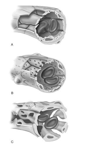 Chapter 19 Review Questions Flashcards Quizlet