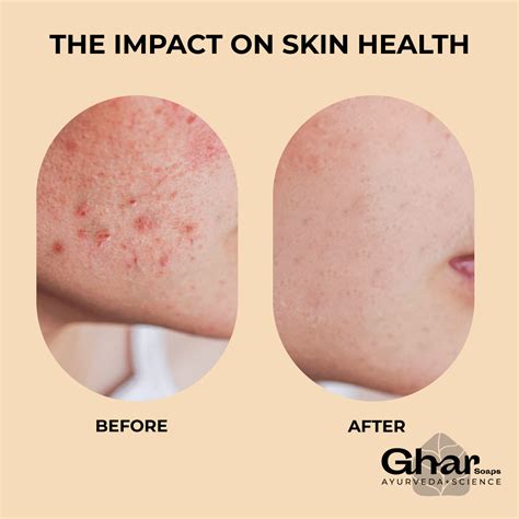 Buy Ghar Soaps Face Clean Towel Pack Of 30 Online In India