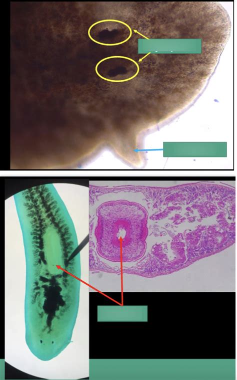 Biol 1111 Lab Practical Platyhelminthes Labels Diagram Quizlet