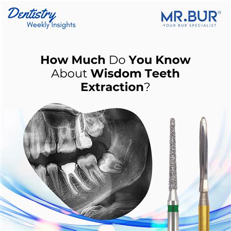 How Much Do You Know About Wisdom Teeth Extraction Mr Bur