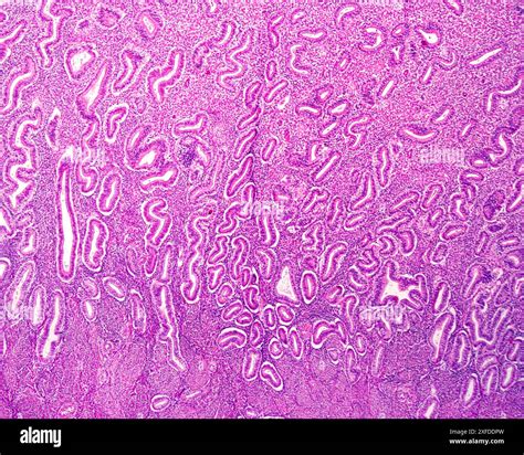 Layers Of Endometrium Histology Endometrium An Overview
