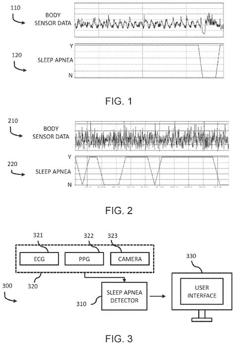 Arrhythmic Heartbeat Resilient Sleep Apnea Detection Eureka Patsnap