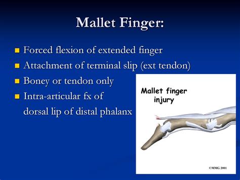 Michael Shuler Md Athens Orthopedic Clinic Aug Ppt Download
