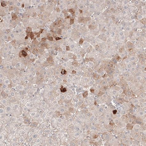 Serum Amyloid A1 Antibody Cl9175 Novus Biologicals™ 100 μg