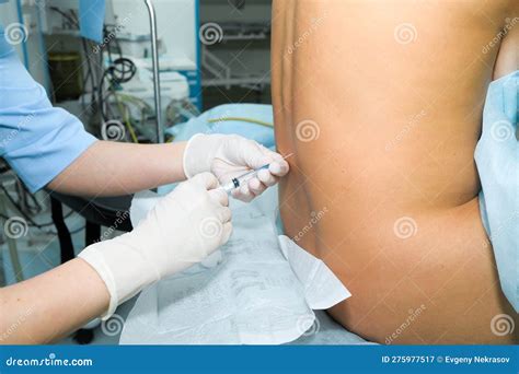 Injection Of Spinal Anesthesia In Preparation For Surgery Stock Image Image Of Closeup Life