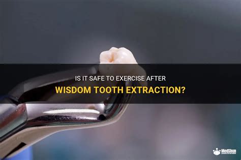 Is It Safe To Exercise After Wisdom Tooth Extraction Medshun
