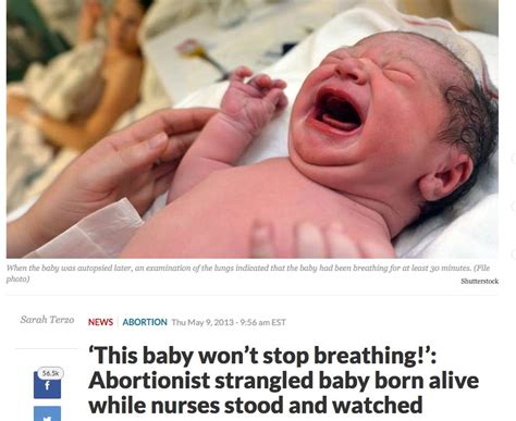 20 Week Aborted Fetus