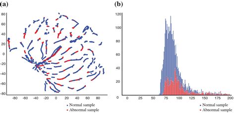 Unsupervised Brain Abnormality Detection Using High Fidelity Image