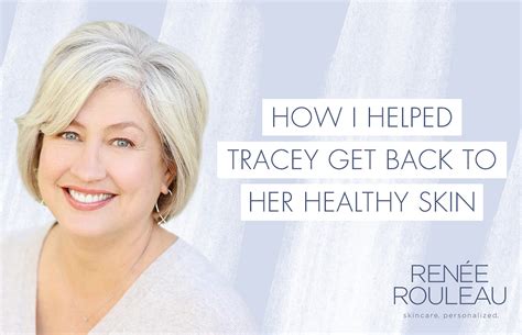 Treating Dry Flaky Red Skin On A Face That Is Sensitive