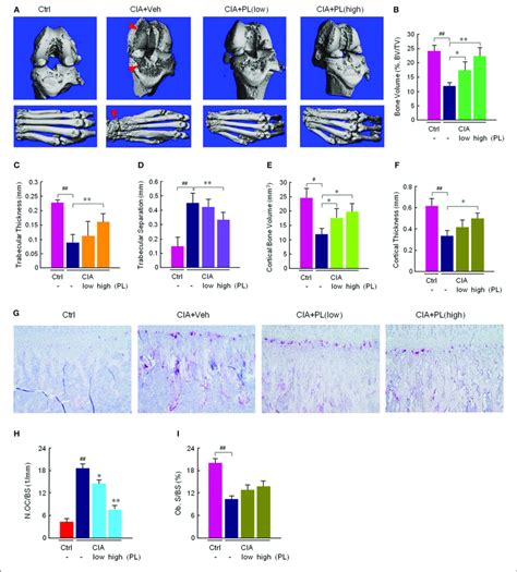 Plumbagin Suppresses Joint Bone Erosion And Tibial Bone Loss In Rats Download Scientific