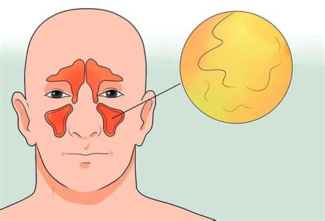 Нафтизин капли в нос для взрослых и детей инструкция по применению
