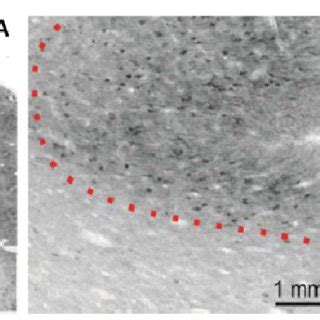 Macroscopic Characteristics Of Phosphorylated Tau P Tau Deposition In Download Scientific