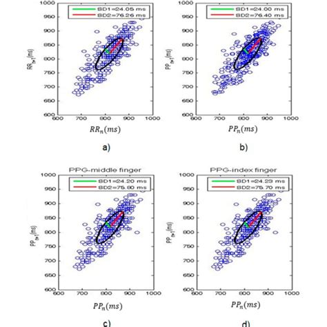 Multifractal Detrended Fluctuation Analysis Mfdfa For Healty Subject Download Scientific
