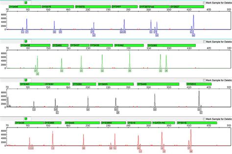 Electropherogram Of A Male Male Dna Mixture Sample 9948 007 At Ratio