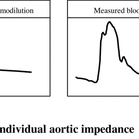 Pdf Pulse Contour Analysis And Transpulmonary Thermodilution