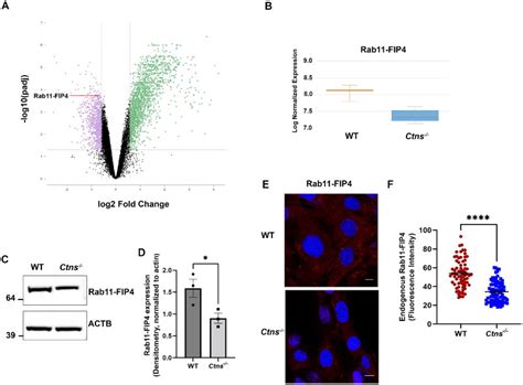 Reconstitution Of Rab11 Fip4 Expression Rescues Cellular Homeostasis In