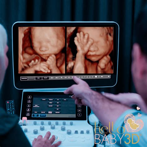 20 Weeks 3d Ultrasound Pictures 20 Week 3d Ultrasound