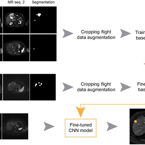 Proposed Lesion Quantification Framework Shown With The Liver Mri As Download Scientific
