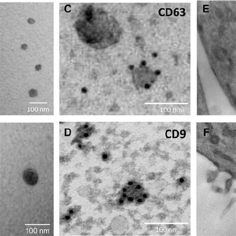 Electron Microscopy Analysis Of Exosomes A And B Representative Download Scientific Diagram