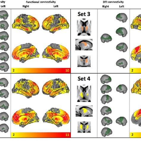 Correlation Matrix Between Spatial Functional Connectivity Networks For Download Scientific