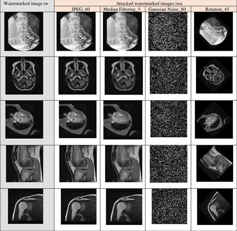Figure 5 From Stationary Wavelet Transform Based Semi Blind Medical