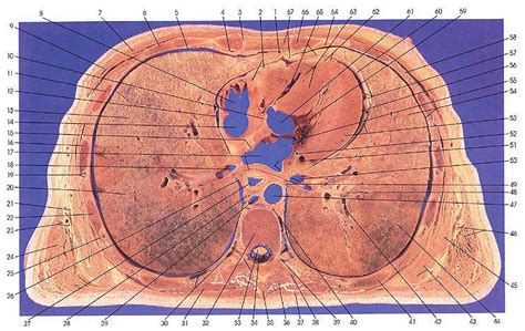 Transverse Section Anatomy