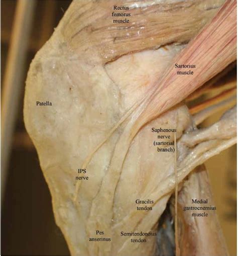 Saphenous Nerve Block
