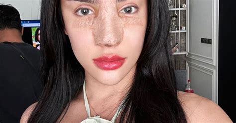 รวมรูปภาพของ นัท นิศามณี แชร์ประสบการณ์หลังเสริมจมูก ด้วยกระดูก