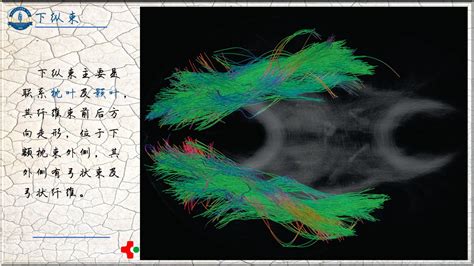 脑白质纤维束的dti表现 脑医汇