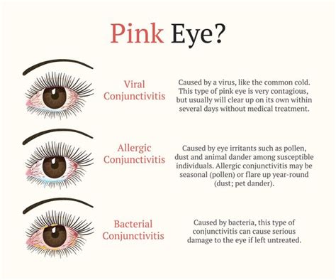 Conjunctivitis Pink Eye Symptoms And How To Tell It Apart From