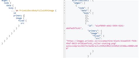 working with images in gatsby developing with prismic prismic people