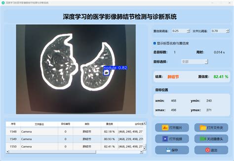 基于yolov8深度学习的医学影像肺结节检测与诊断系统研究与实现pyqt5界面数据集训练代码深度学习肺结节检测代码 Csdn博客