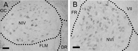 Immunoreactive Perikarya Containing Met Enk Located In The Nucleus