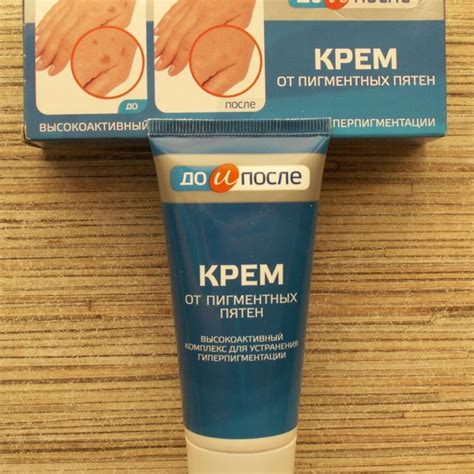 Крема От Пигментных Пятен Фото — Картинки фотографии